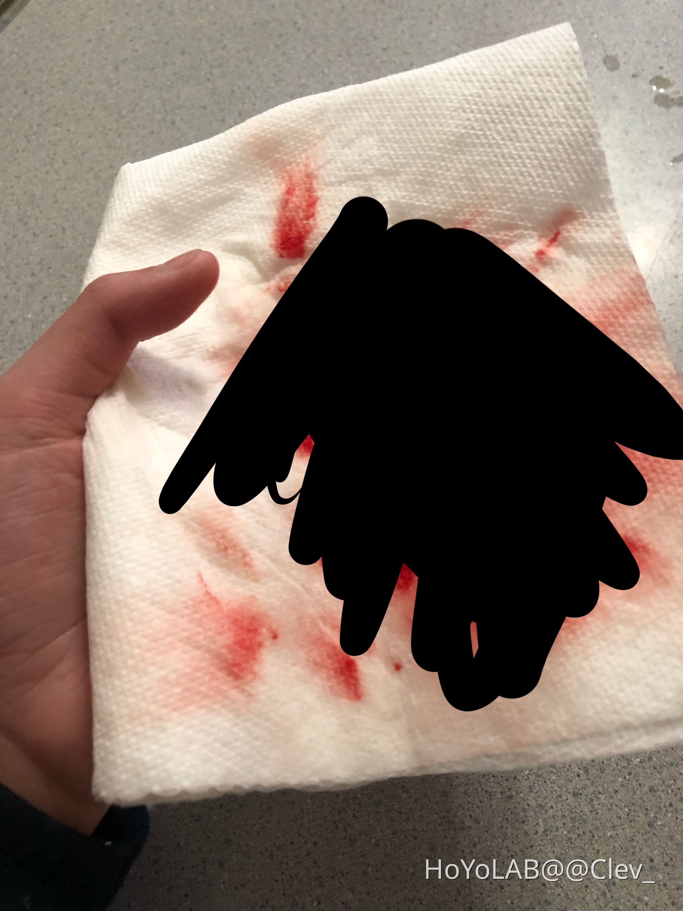 Moral of the Story: No More Spinny-Spinny in Desk Chair. | HoYoLAB