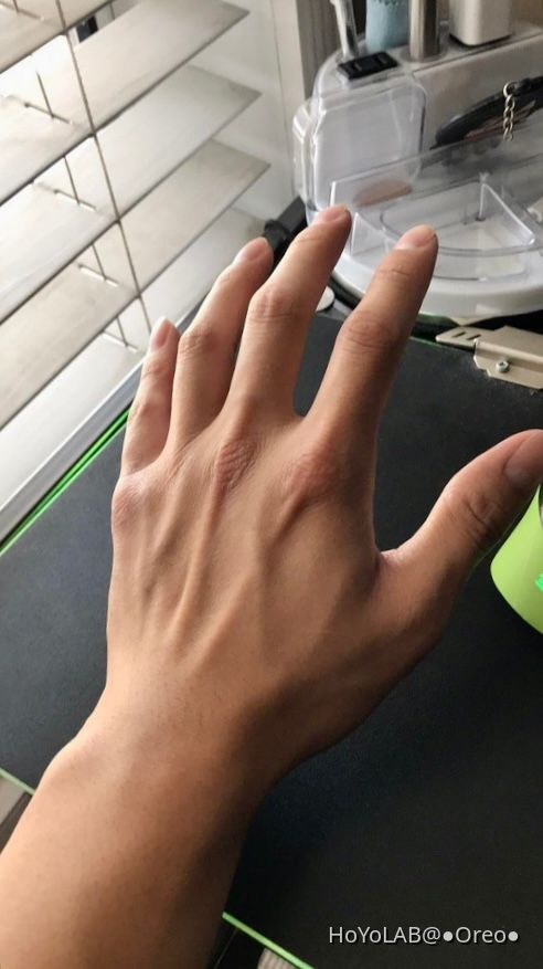 Uhhh one of u asked me to show my hand… its kinda weird but here you go ...