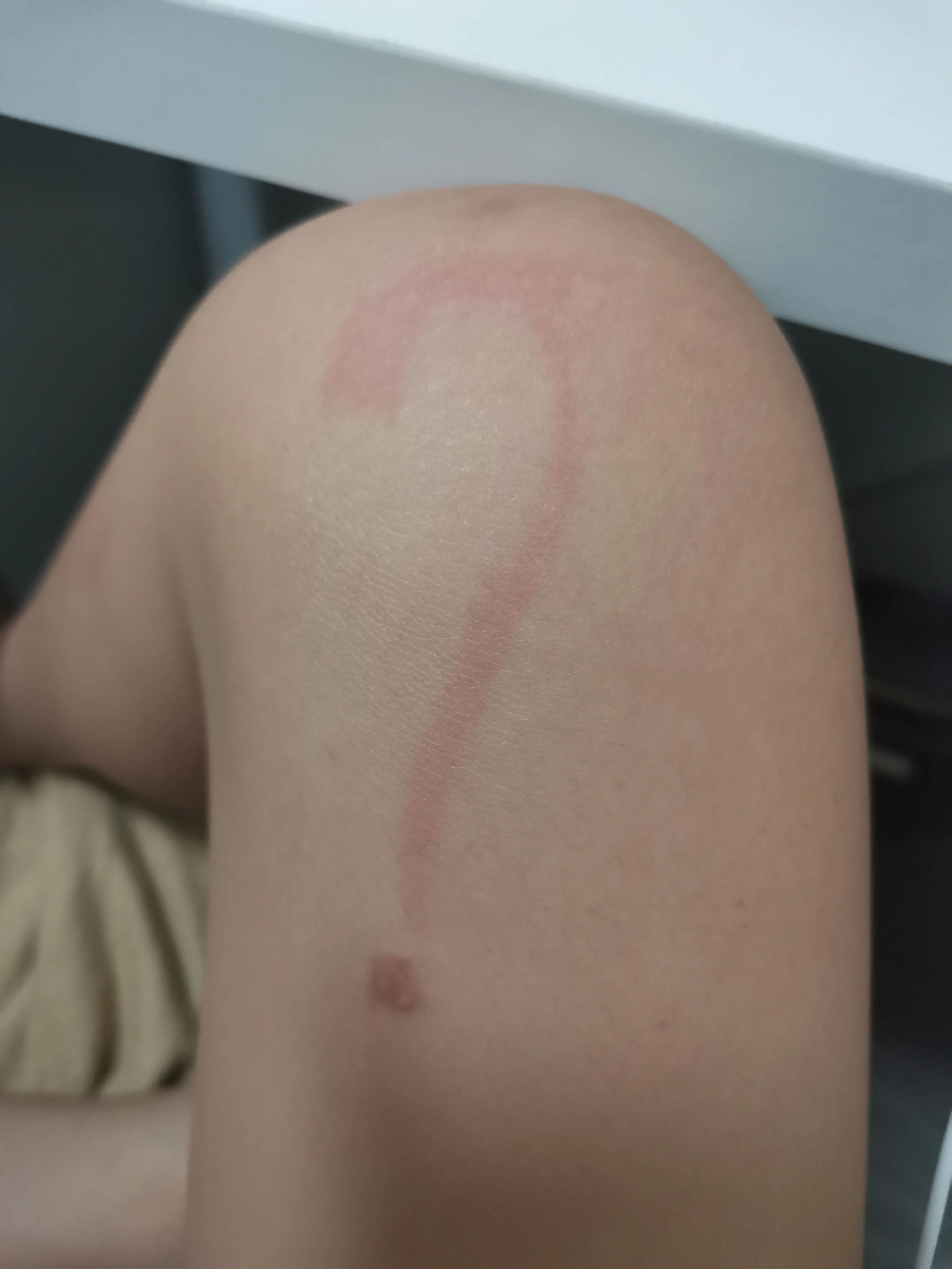 HELP WHY DOES MY LEG HAVE A QUESTION MARK HoYoLAB HELP WHY DOES MY LEG HAVE A QUESTION MARK HoYoLAB