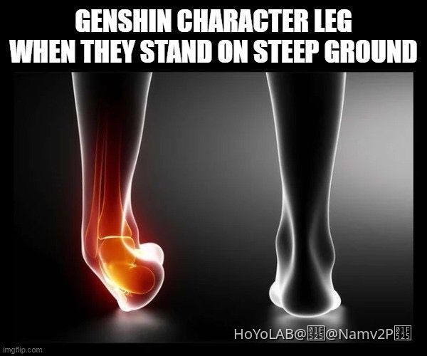 Leg break physics Genshin Impact | HoYoLAB