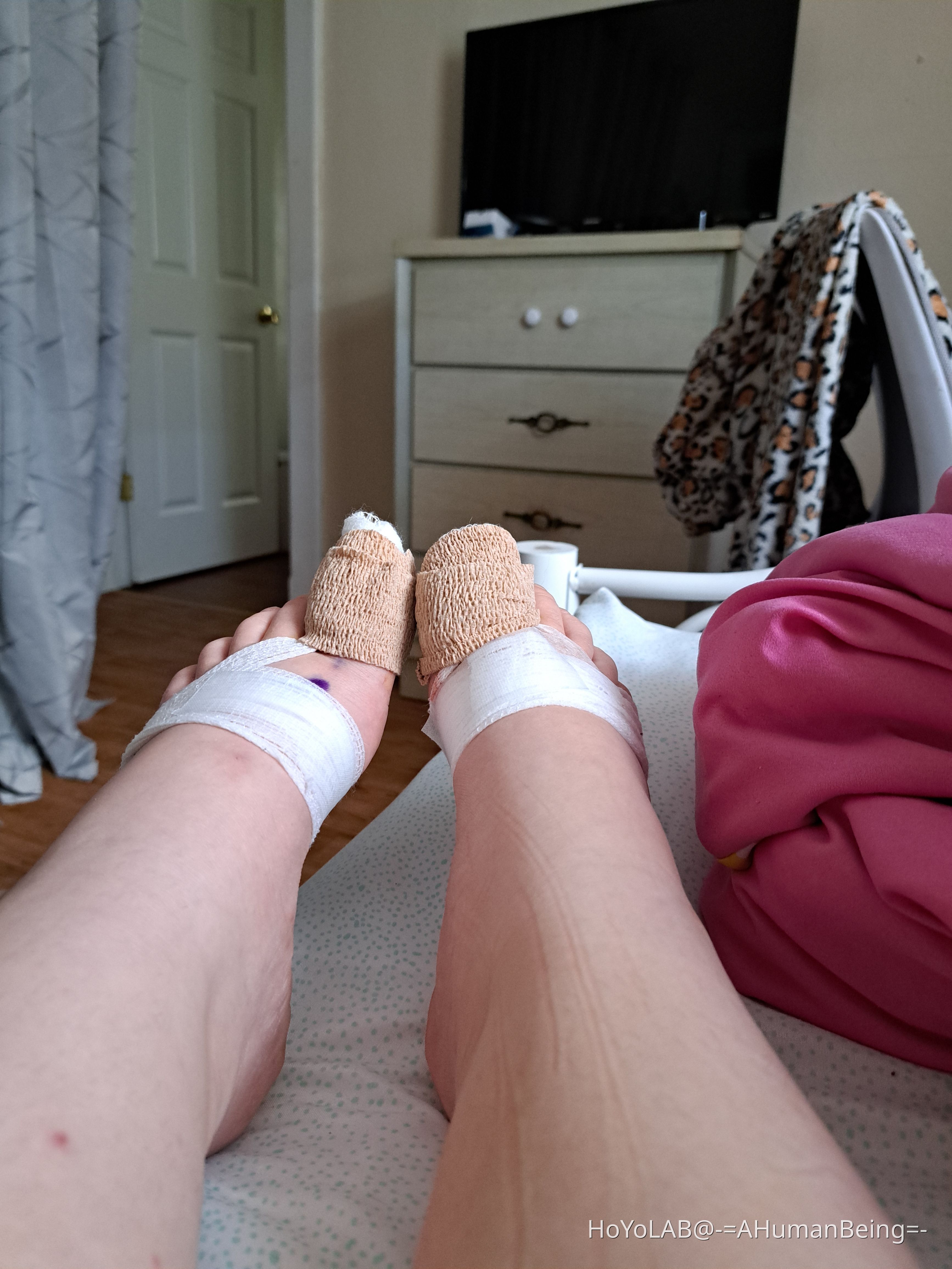 Recovering from surgery | HoYoLAB