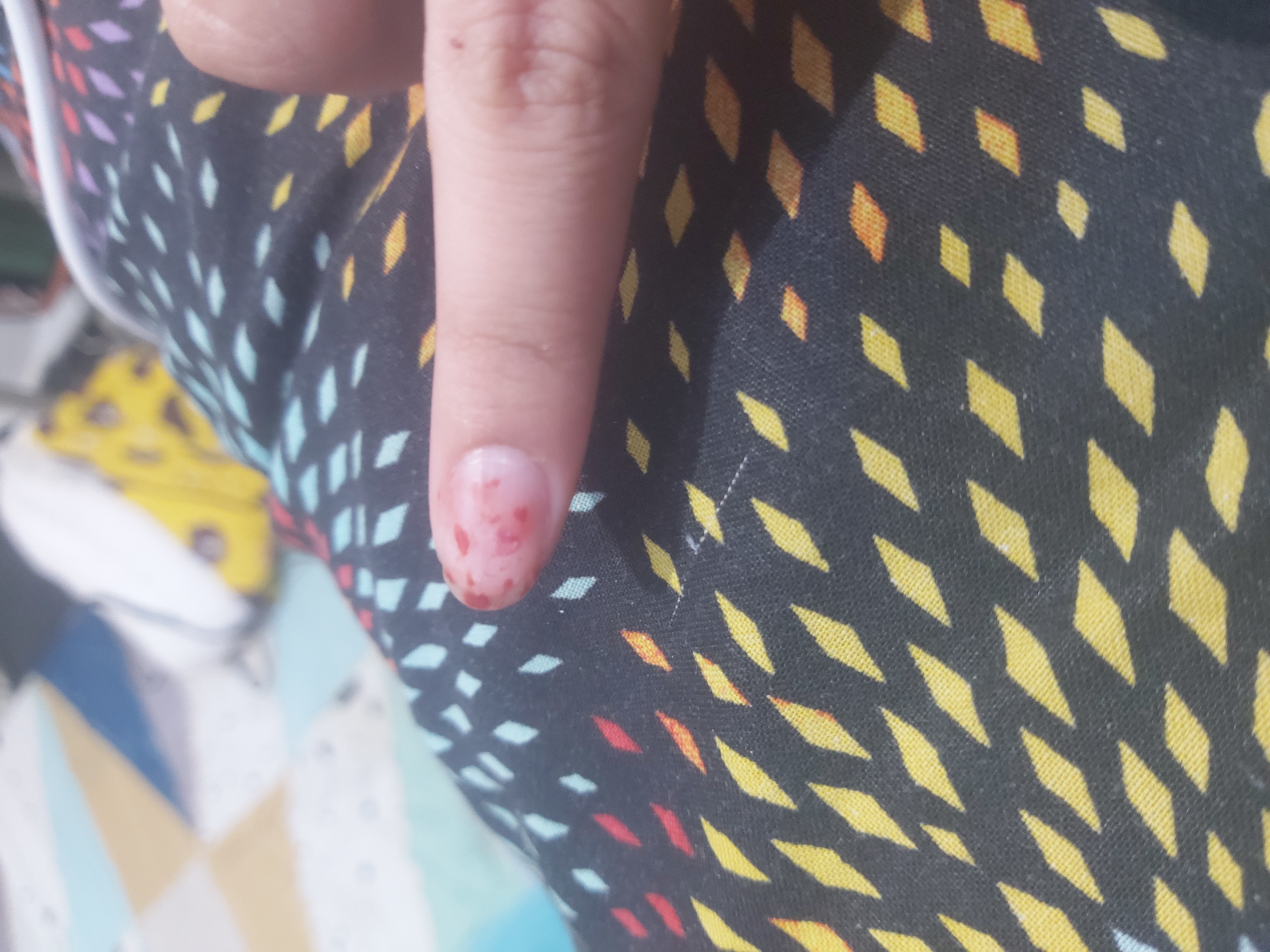 OMG, YUMMERZ BLOOD | HoYoLAB
